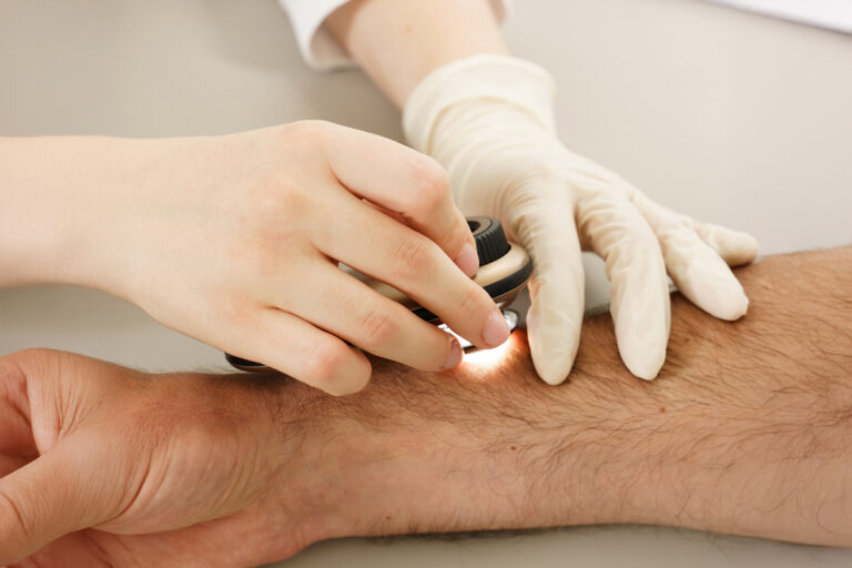 Skin Cancer Screening in Bridgewater, NJ | Skin Cancer Exams