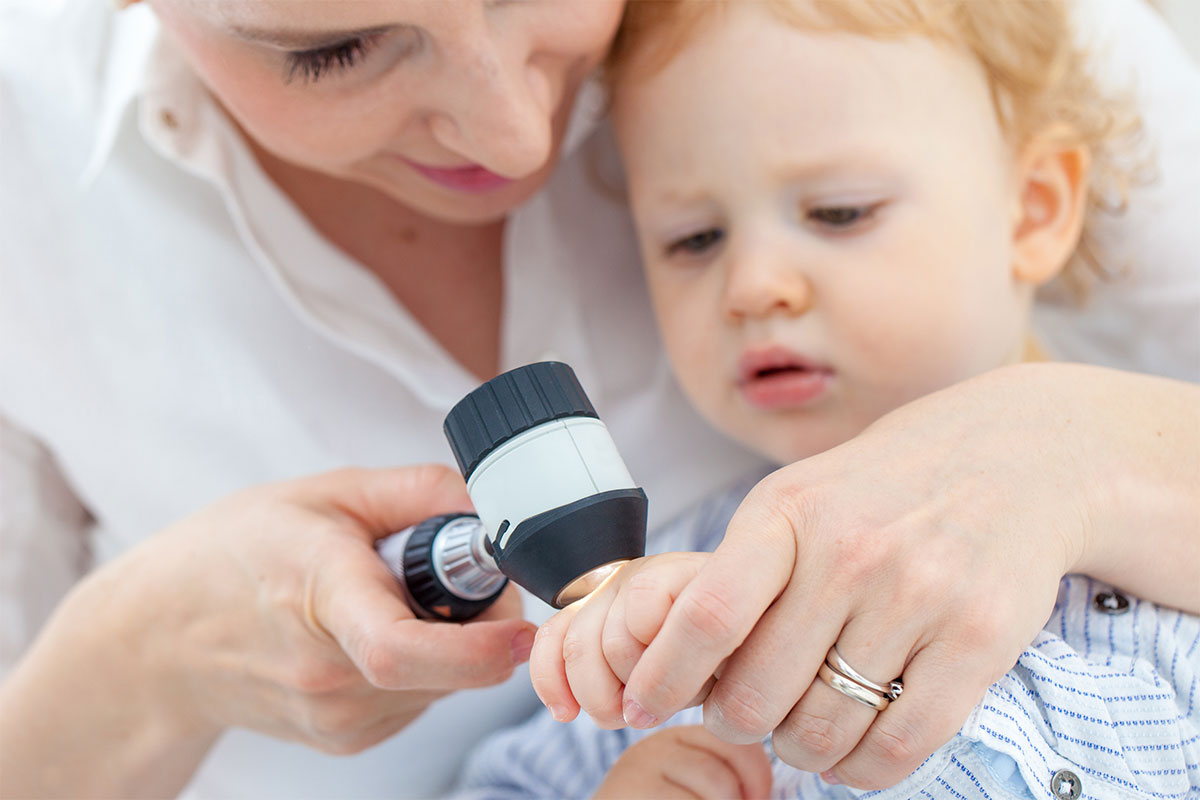 Hives Treatment in Bridgewater, NJ | Curated Dermatology